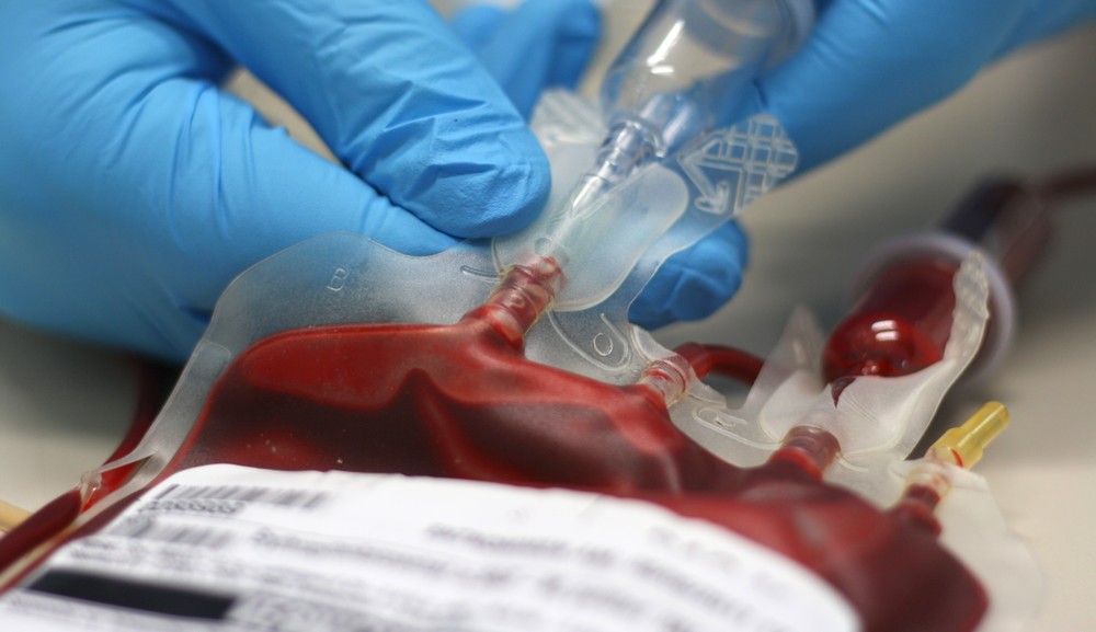 Des cellules souches immortalisées permettent aux scientifiques de ...