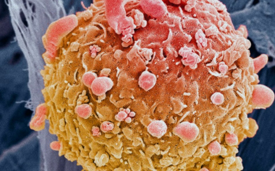 Genèse des recherches dans le domaine de la lutte contre la cancer (de ...