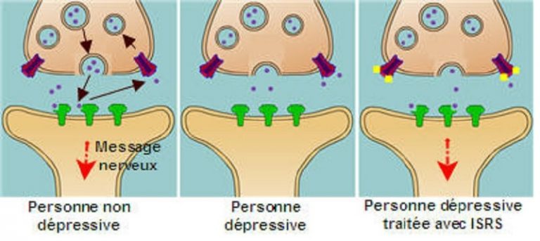 L'hyperactivité des neurones pourrait expliquer l'inefficacité des ...