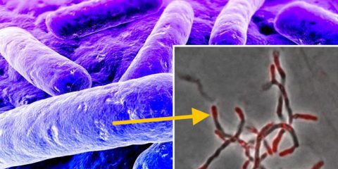Les différents types de réactions chimiques (+exemples)