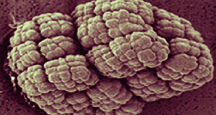 Bactérie « invincible » : qui est Keinococcus radiotolerans