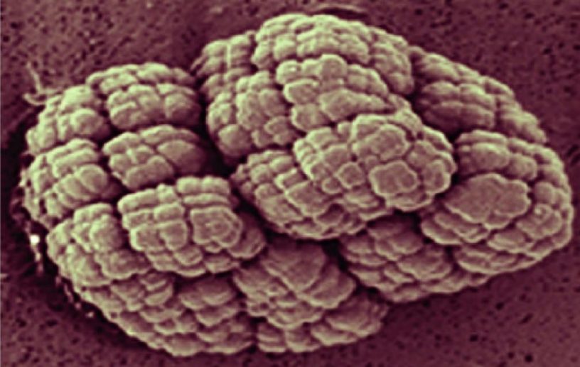 Bactérie « invincible » : qui est Keinococcus radiotolerans