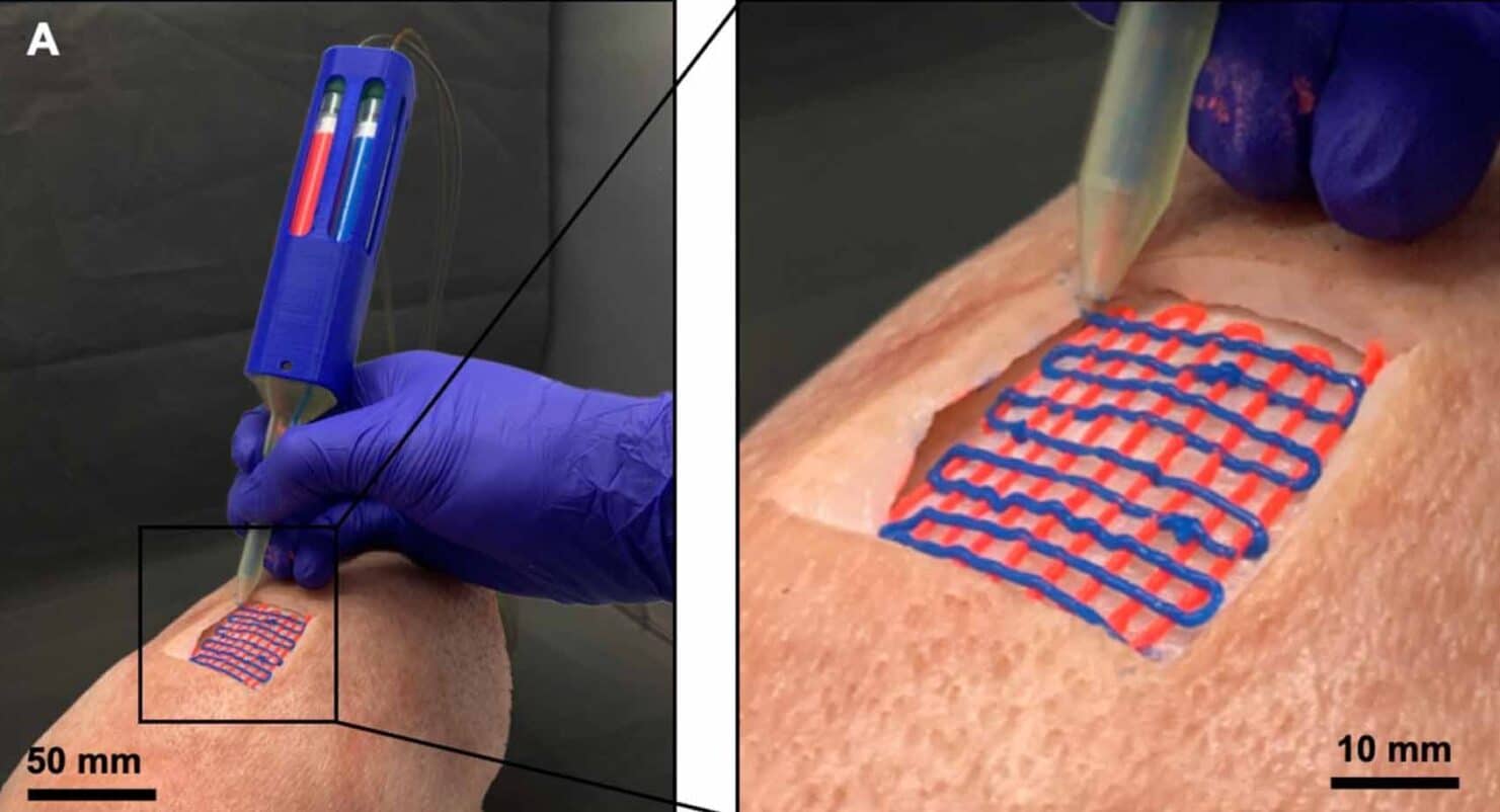 Une bioimprimante 3D portable et ultra polyvalente produit des tissus ...