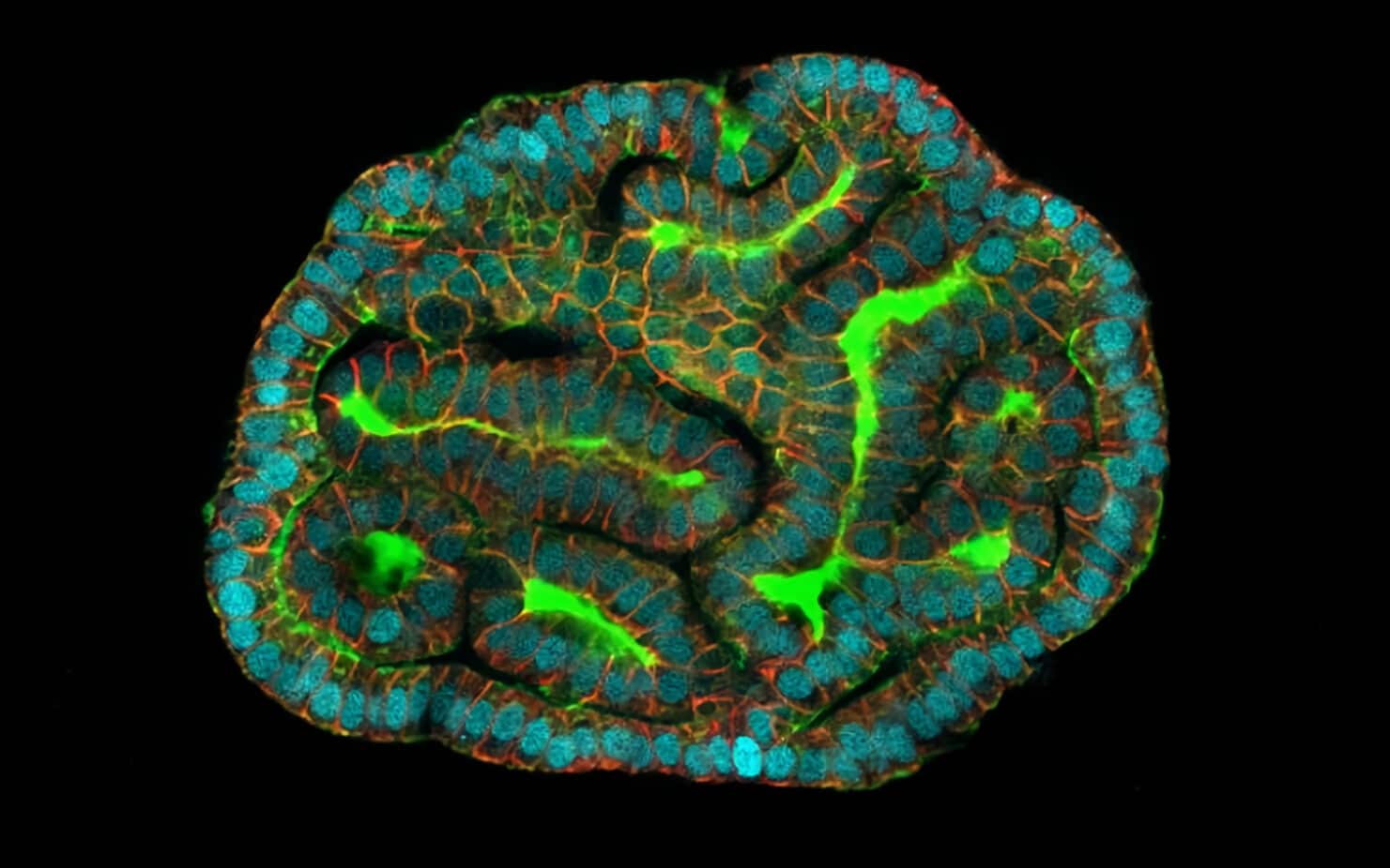Première : des chercheurs ont créé des organoïdes à partir de cellules ...